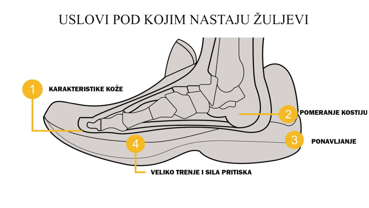 Žuljevi - ZDRAV I PRAV